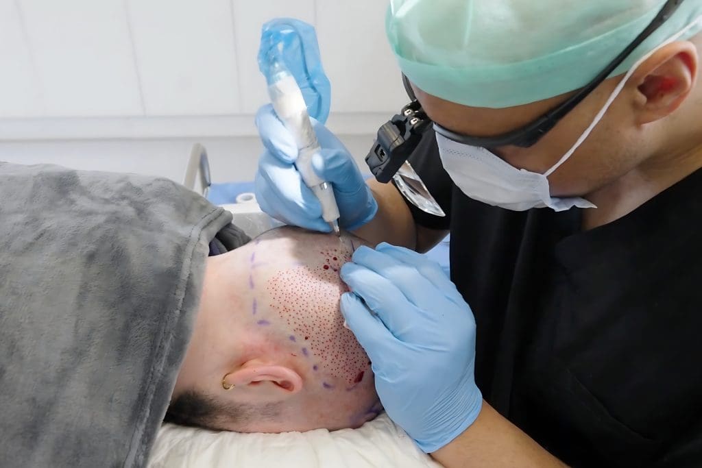 Hair Transplants Ireland - Total Hair Restoration